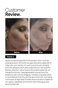 Granactive Retinoid 2% Anti-Aging Cream for Wrinkles & Fine Lines ...