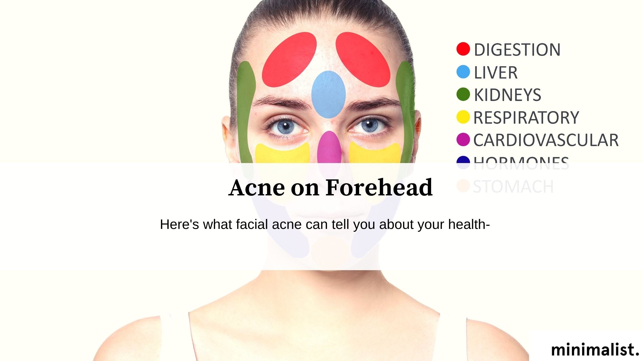Forehead Acne: Causes and Treatment – Minimalist