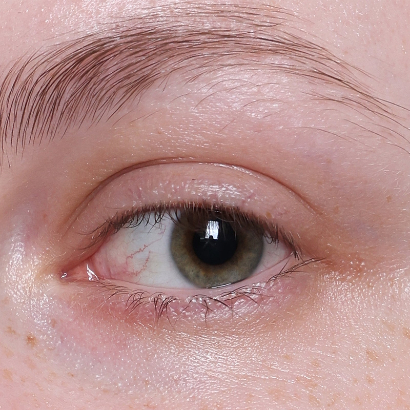 Eye Balm by REFY - Free EU Delivery on Orders €60+